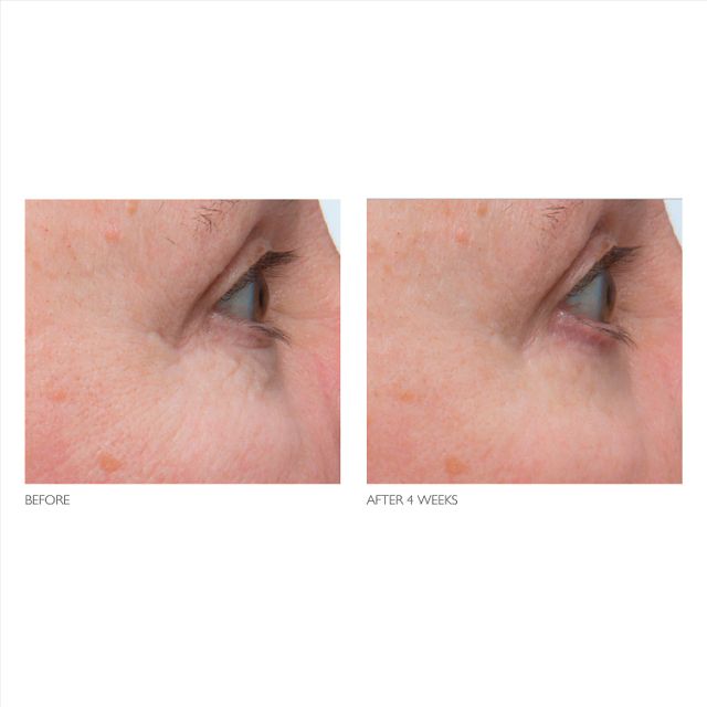 Kate Somerville Retinol Firming Eye Cream | Pacific City