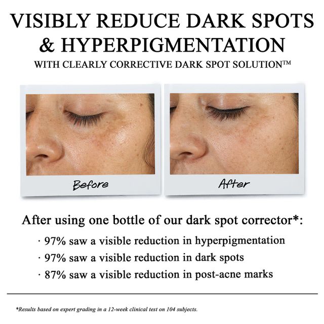 Kiehl's Since 1851 Clearly Corrective Dark Spot Correcting Serum ...