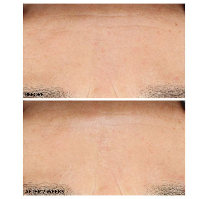Dr. Dennis Gross Skincare Alpha Beta™ Advanced Liquid Peel | Hamilton Place