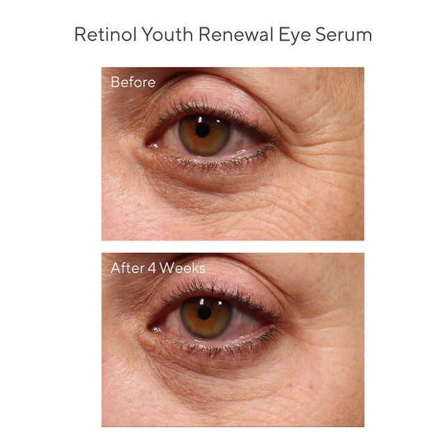 Murad Youth Renewal Retinol Trial Kit for Smoother, Younger-Looking ...