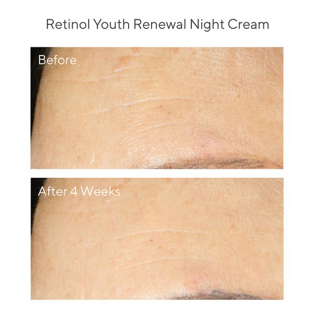 Murad Youth Renewal Retinol Trial Kit for Smoother, Younger-Looking ...