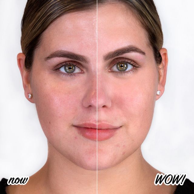 Free-radicals-skin | Mall of America®