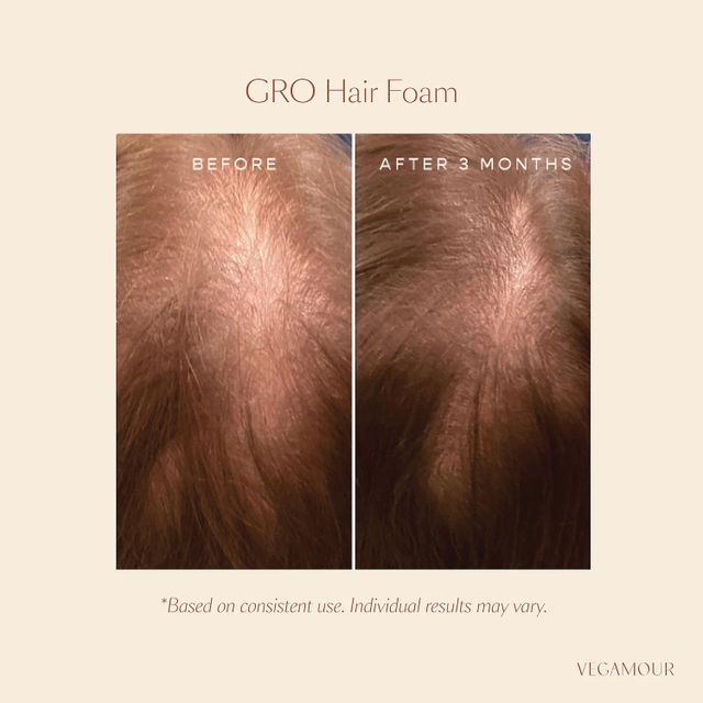 Vegamour GRO Hair Foam for Thinning Hair | CoolSprings Galleria