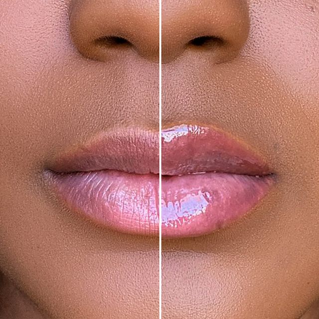 Too Faced Lip Injection Before After